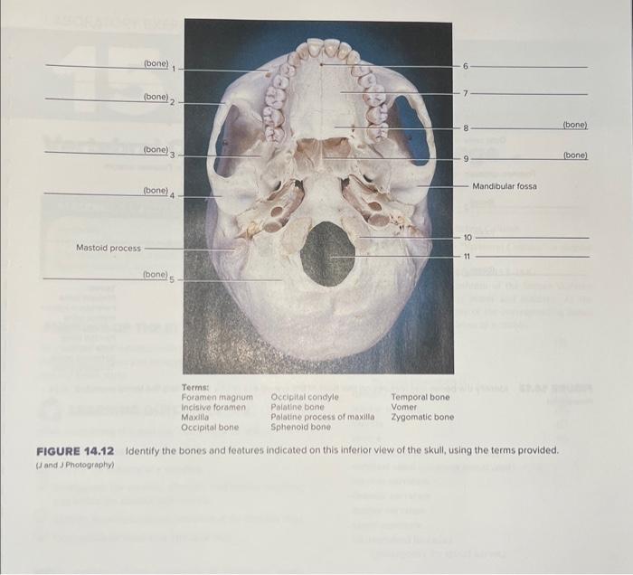 Solved FIGURE 14.10 Identify the bones and features | Chegg.com