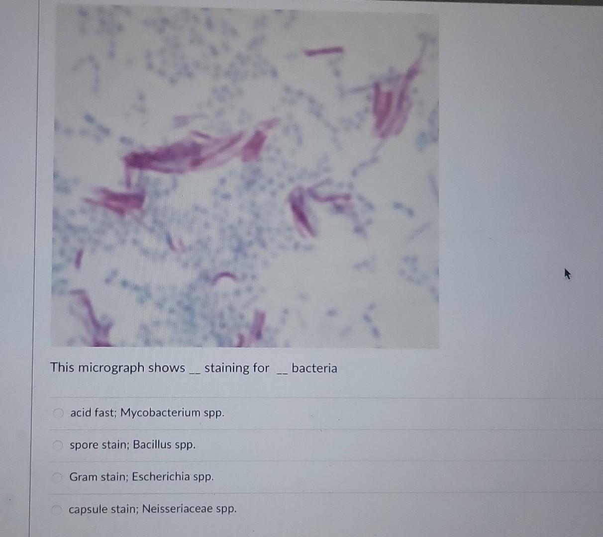 Solved This micrograph shows _ staining for bacteria acid | Chegg.com