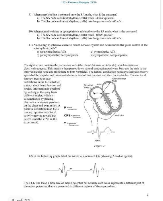 Solved 9) When acetylcholine is released onto the SA node, | Chegg.com