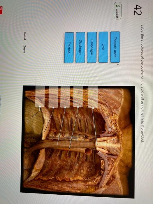 Solved Label the structures of the posterior thoracic wall | Chegg.com
