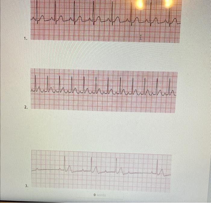 Solved Instructions: Step 1: Identify each of the three ECG | Chegg.com