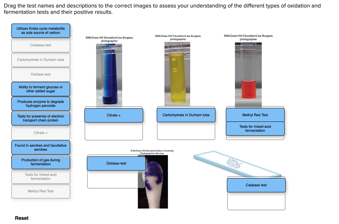 Solved Drag the test names and descriptions to the correct | Chegg.com