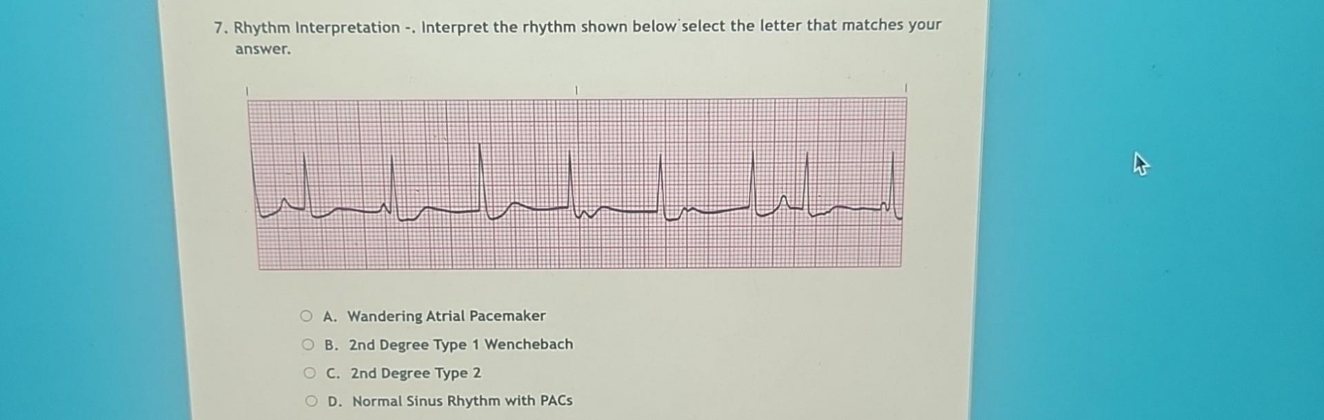 Solved 7. Rhythm Interpretation -. Interpret the rhythm | Chegg.com
