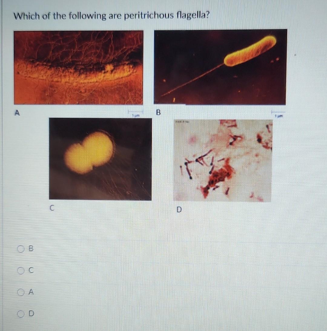 Solved Which of the following are peritrichous flagella? B | Chegg.com