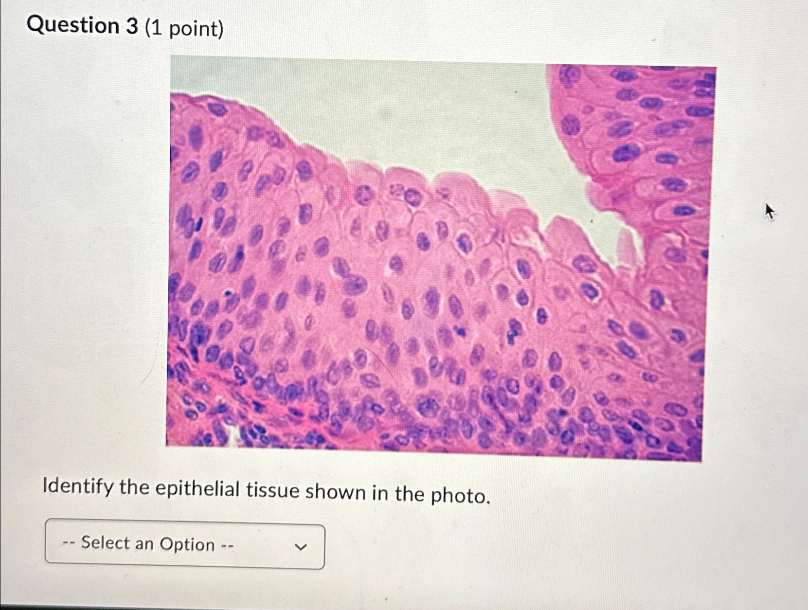Solved Question 3 (1 point)Identify the epithelial tissue | Chegg.com Solved Question 3 (1 point)Identify the epithelial tissue | Chegg.com