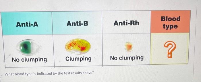 Solved Anti-A Anti-B Anti-Rh Blood type ? No clumping | Chegg.com