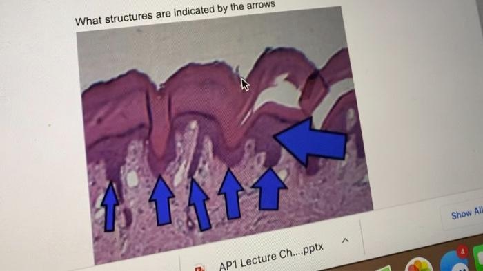 Solved What structures are indicated by the arrows Show All | Chegg.com