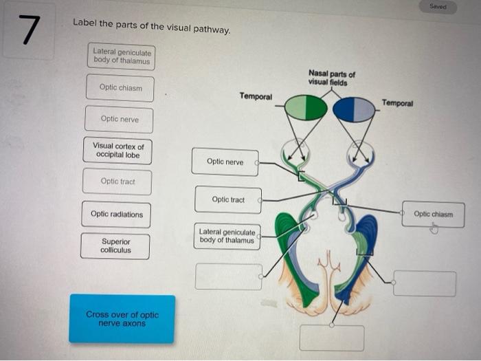 Solved Saved Label the parts of the visual pathway. 7 | Chegg.com