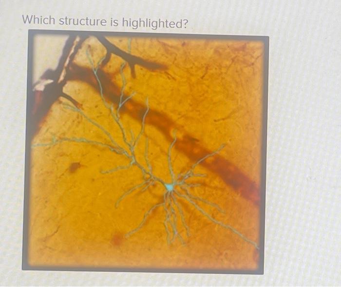 Solved Which structure is highlighted? Multiple Choice | Chegg.com