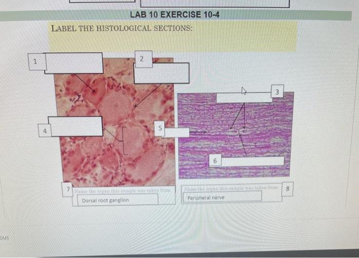 Solved 175 LAB 10 EXERCISE 10-3 Label the following glia & | Chegg.com