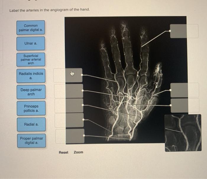 Solved Hand angiogram AP Label the arteries in the angiogram | Chegg.com