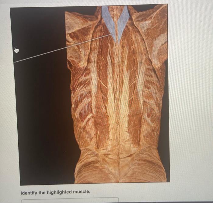Solved 747 The highlighted muscle inserts onto two different | Chegg.com