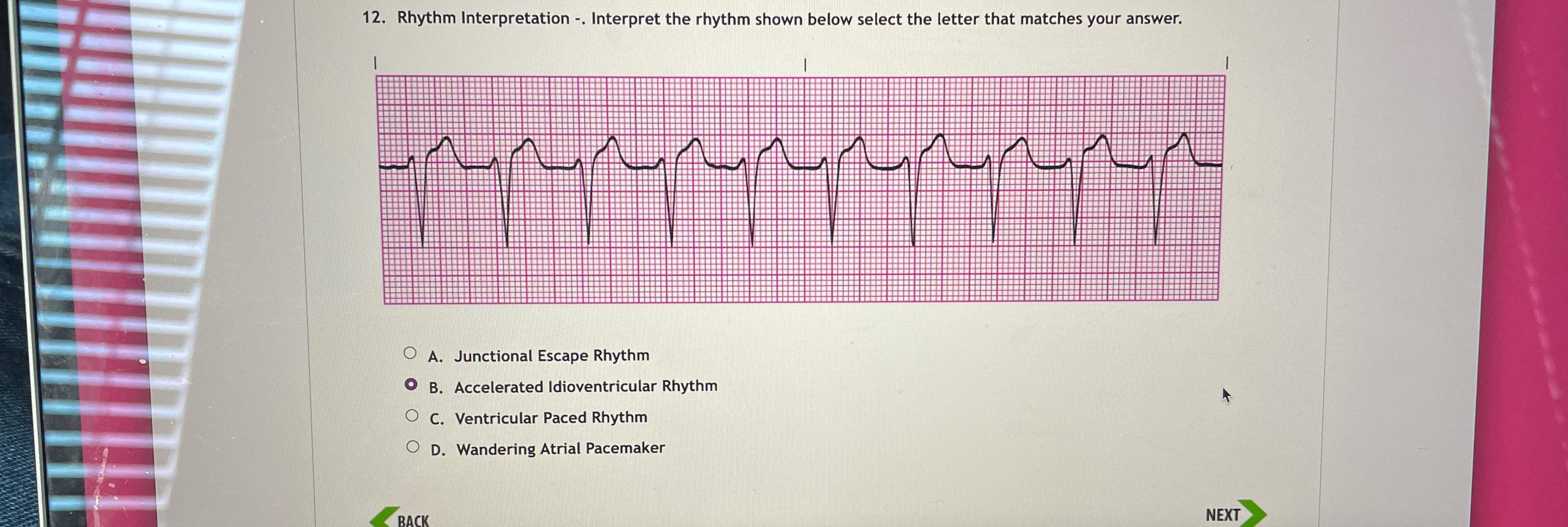 Solved Rhythm Interpretation -. ﻿Interpret the rhythm shown | Chegg.com