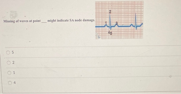 Solved Missing of waves at point might indicate SA node | Chegg.com