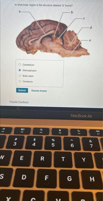 Solved * F2 >> S In what brain region is the structure | Chegg.com