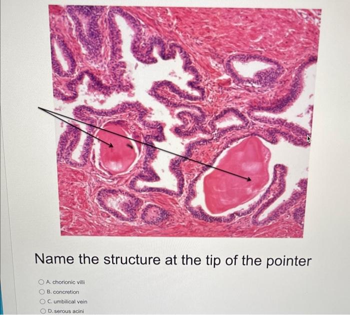 Solved Name the structure at the tip of the pointer A. | Chegg.com