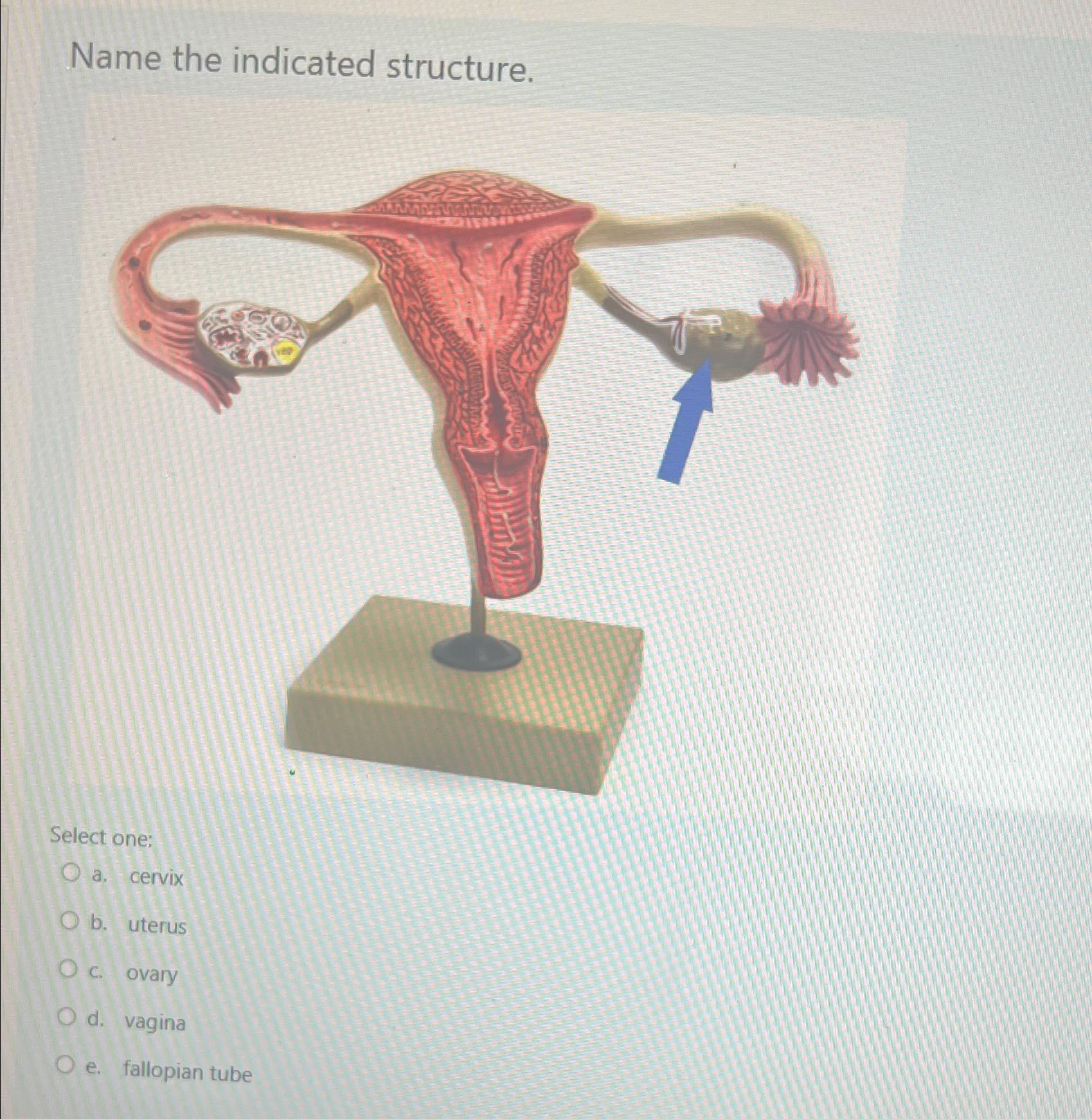 Name the indicated structure.Select one:a. ﻿cervixb. | Chegg.com