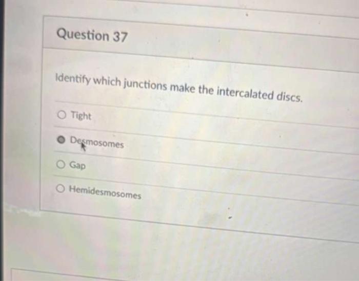 Solved Question 37 Identify which junctions make the | Chegg.com