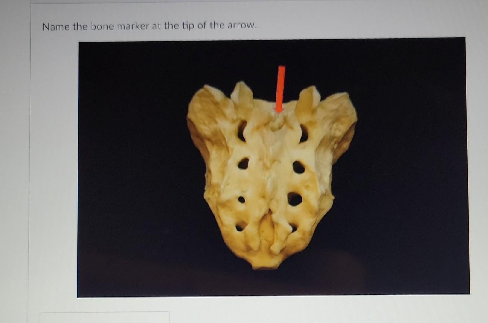 Solved Name the bone marker at the tip of the arrow. Name | Chegg.com
