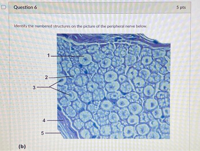 Solved Identify the numbered structures on the picture of | Chegg.com