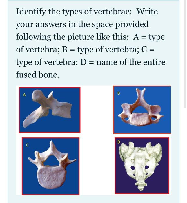 Solved Identify the bone or bony landmarks: Write your | Chegg.com