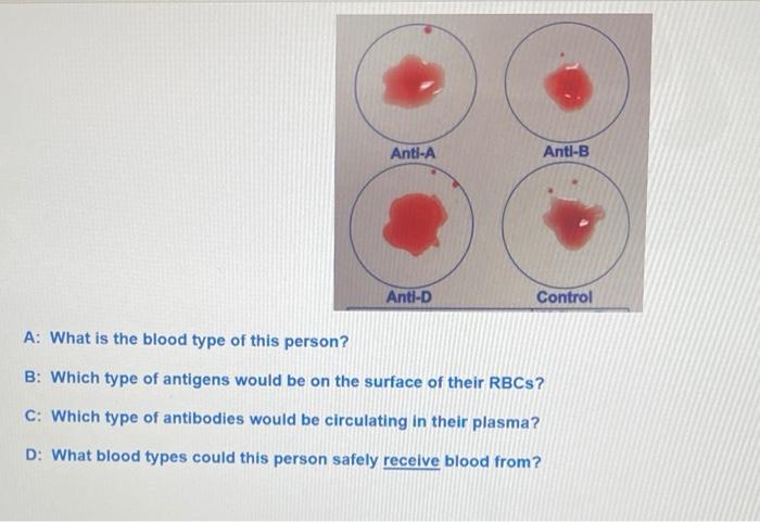 Solved Blood Typing EldonCard Results indicate the blood | Chegg.com