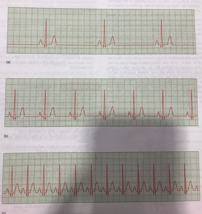 Solved For these three, how would you calculate QRS complex, | Chegg.com