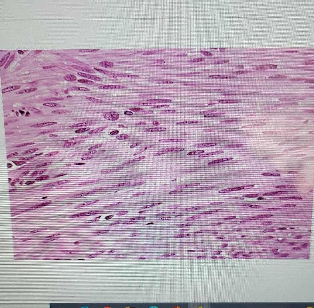 Solved sue. PRO fe regular tissue | Chegg.com