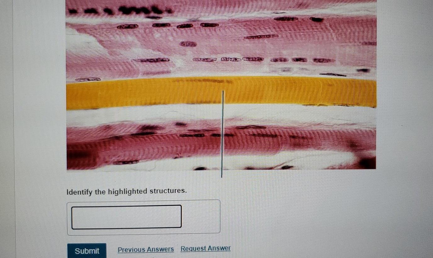 Solved 一一一一一一一一 Identify the highlighted structures. Submit | Chegg.com