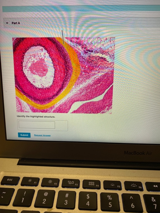 Solved: PAL: Histology > Cardiovascular System > Lab Pract... | Chegg.com