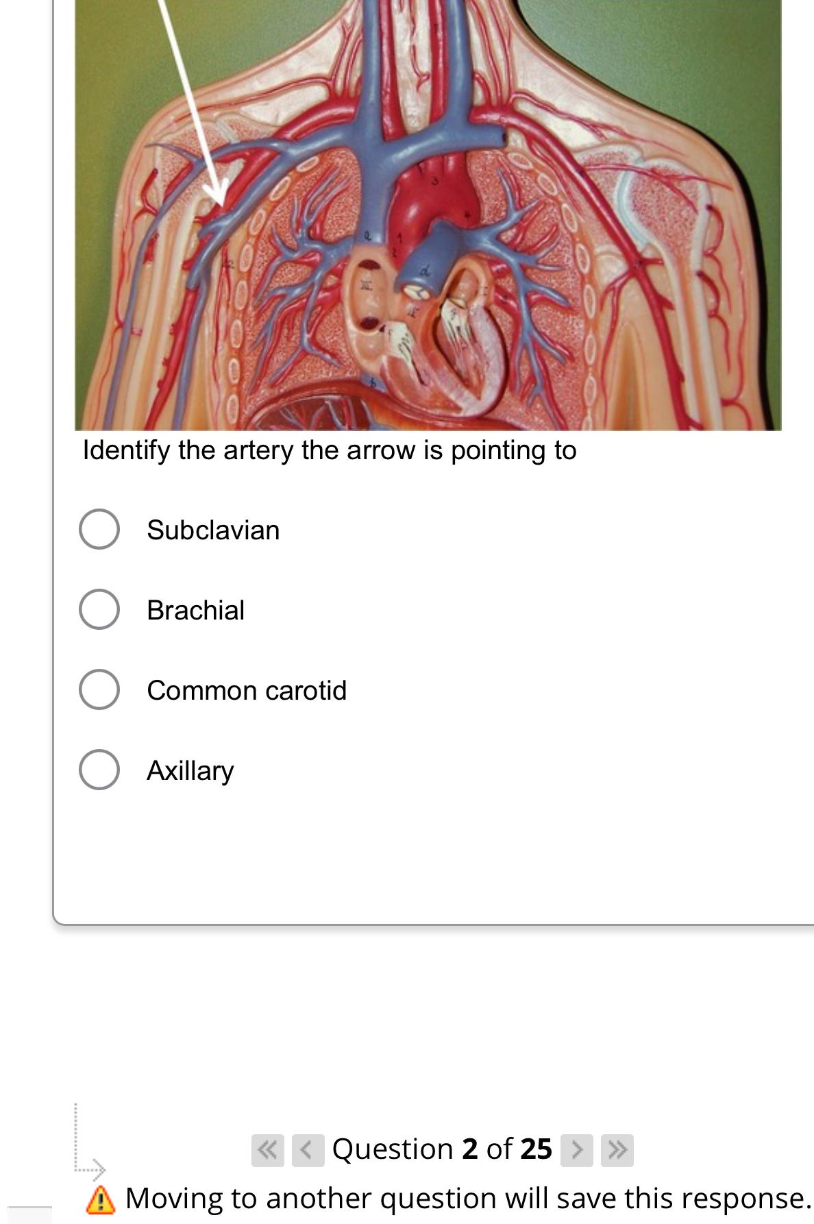 Solved Identify the artery the arrow is pointing | Chegg.com