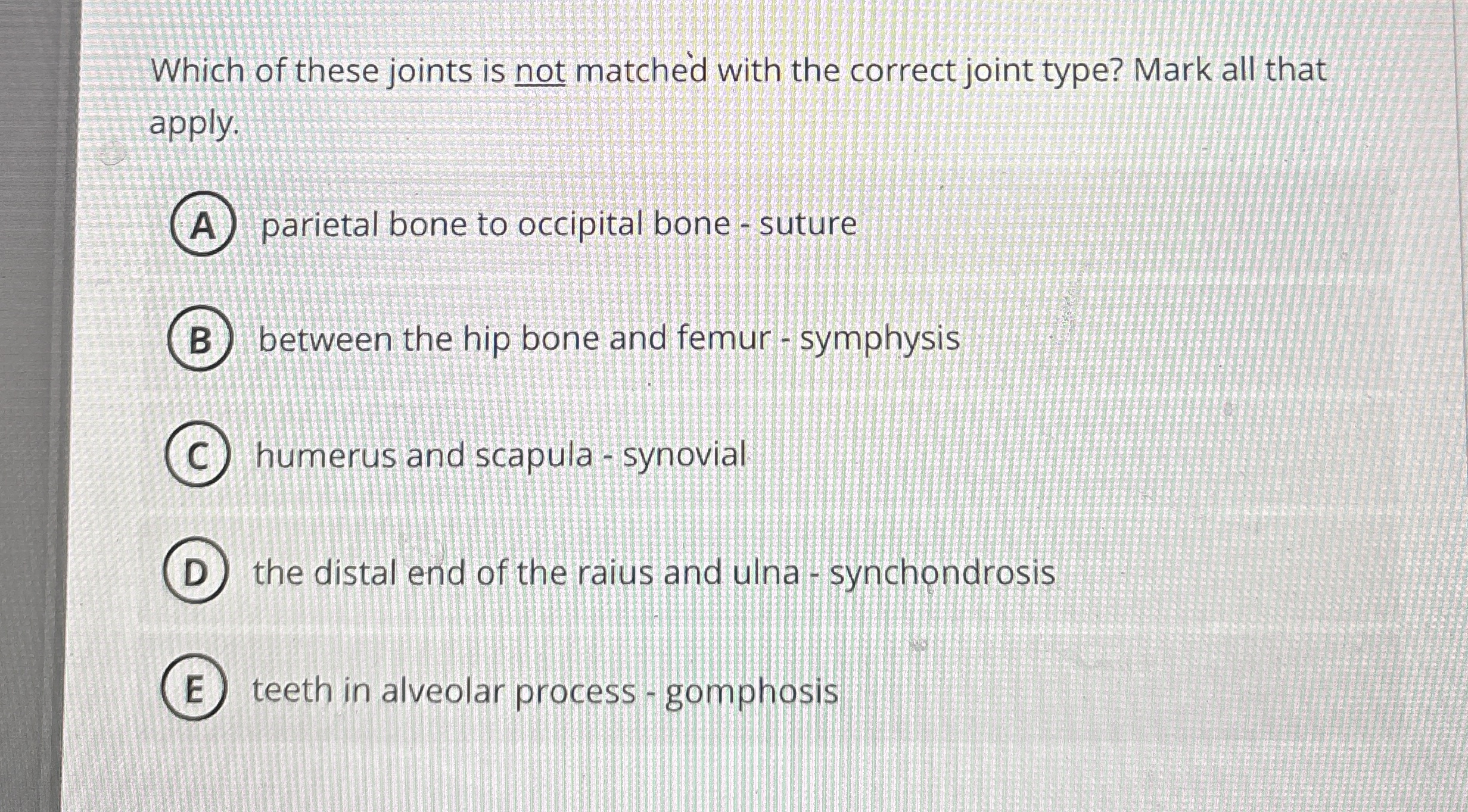 Solved Which of these joints is not matched with the correct | Chegg.com