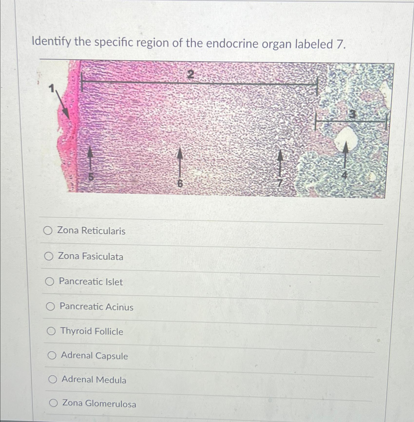 Solved Identify the specific region of the endocrine organ | Chegg.com