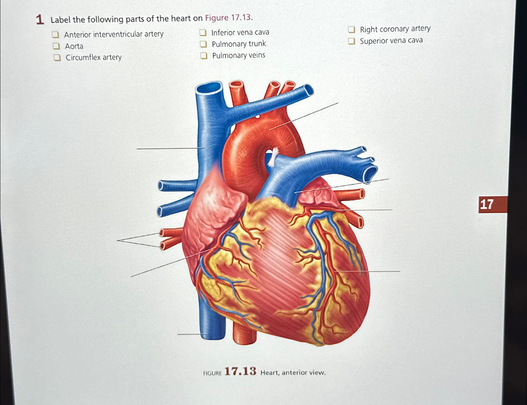 Solved 1 ﻿Label the following parts of the heart on Figure | Chegg.com