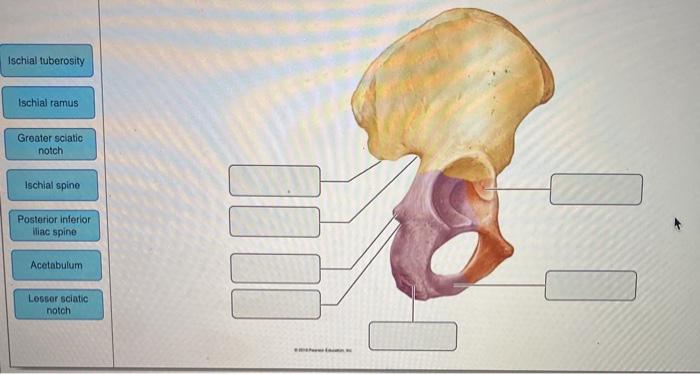 Solved Ischial tuberosity Ischial ramus Greater sciatic | Chegg.com