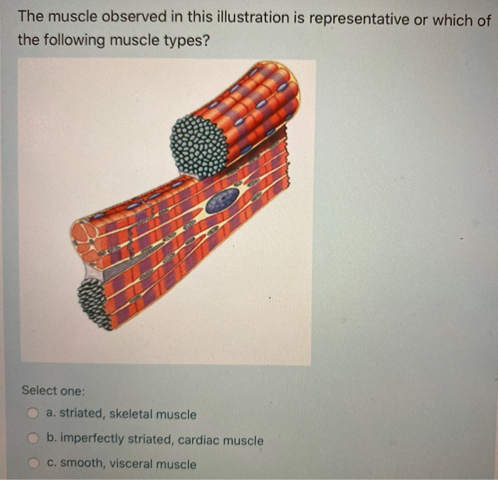 Solved Which of the following layers represents the fibrous | Chegg.com