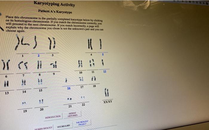 Karyotyping Activity Patient A's Karyotype Place this | Chegg.com