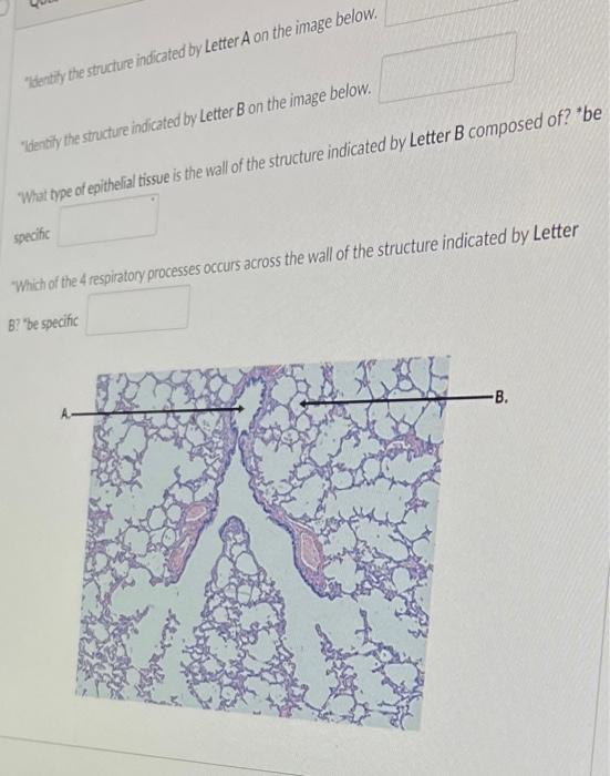 Solved "Bentify the structure indicated by Letter A on the | Chegg.com