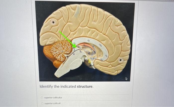 Solved 10 105 Identify the indicated structure. superior | Chegg.com