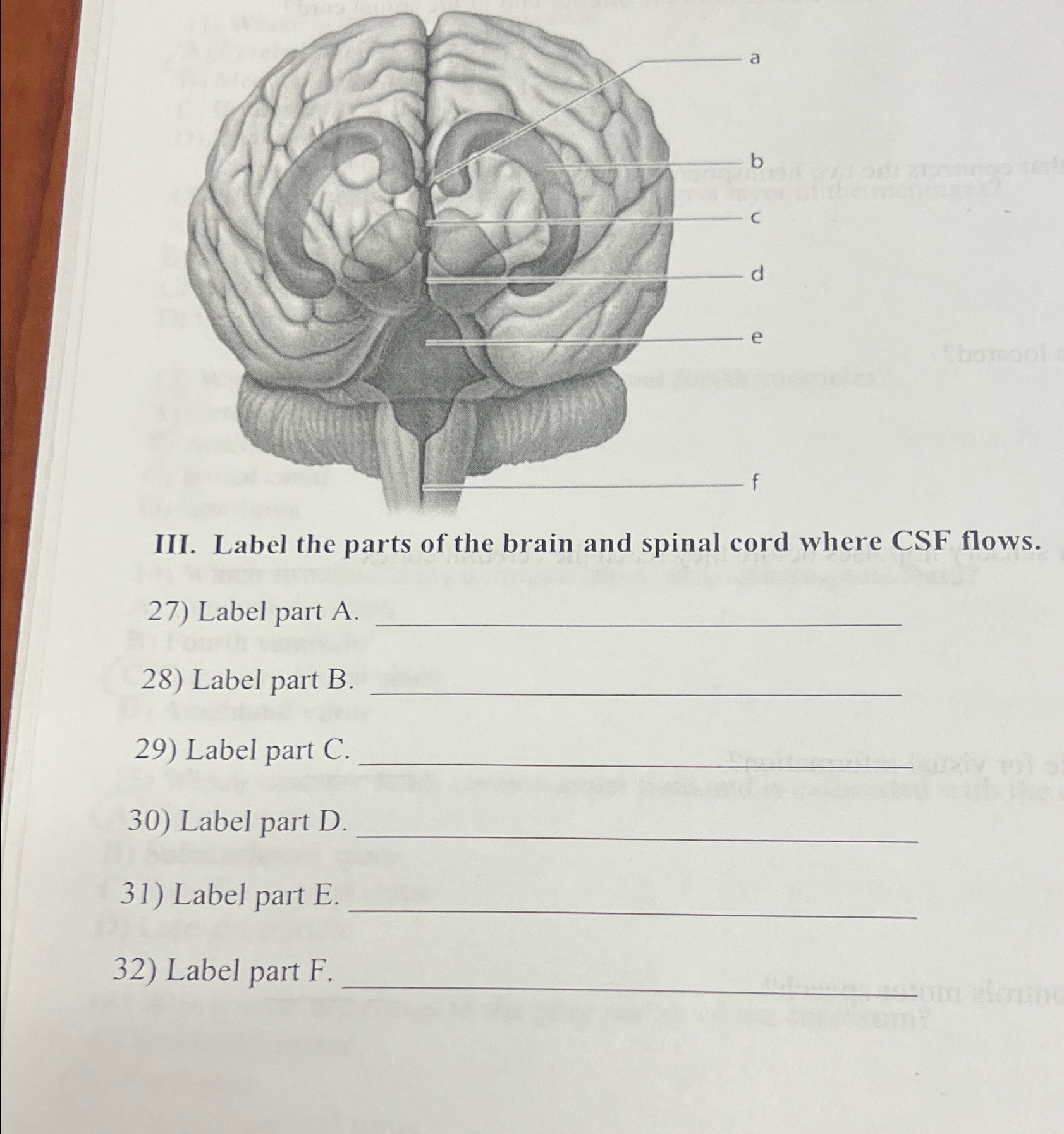 Solved III. Label the parts of the brain and spinal cord | Chegg.com