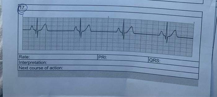 Solved P, Q, R, S, T, U UMass Memorial Medical Center | Chegg.com