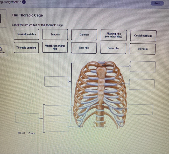 Solved g Assignment 7 0 Saved The Thoracic Cage Label the | Chegg.com