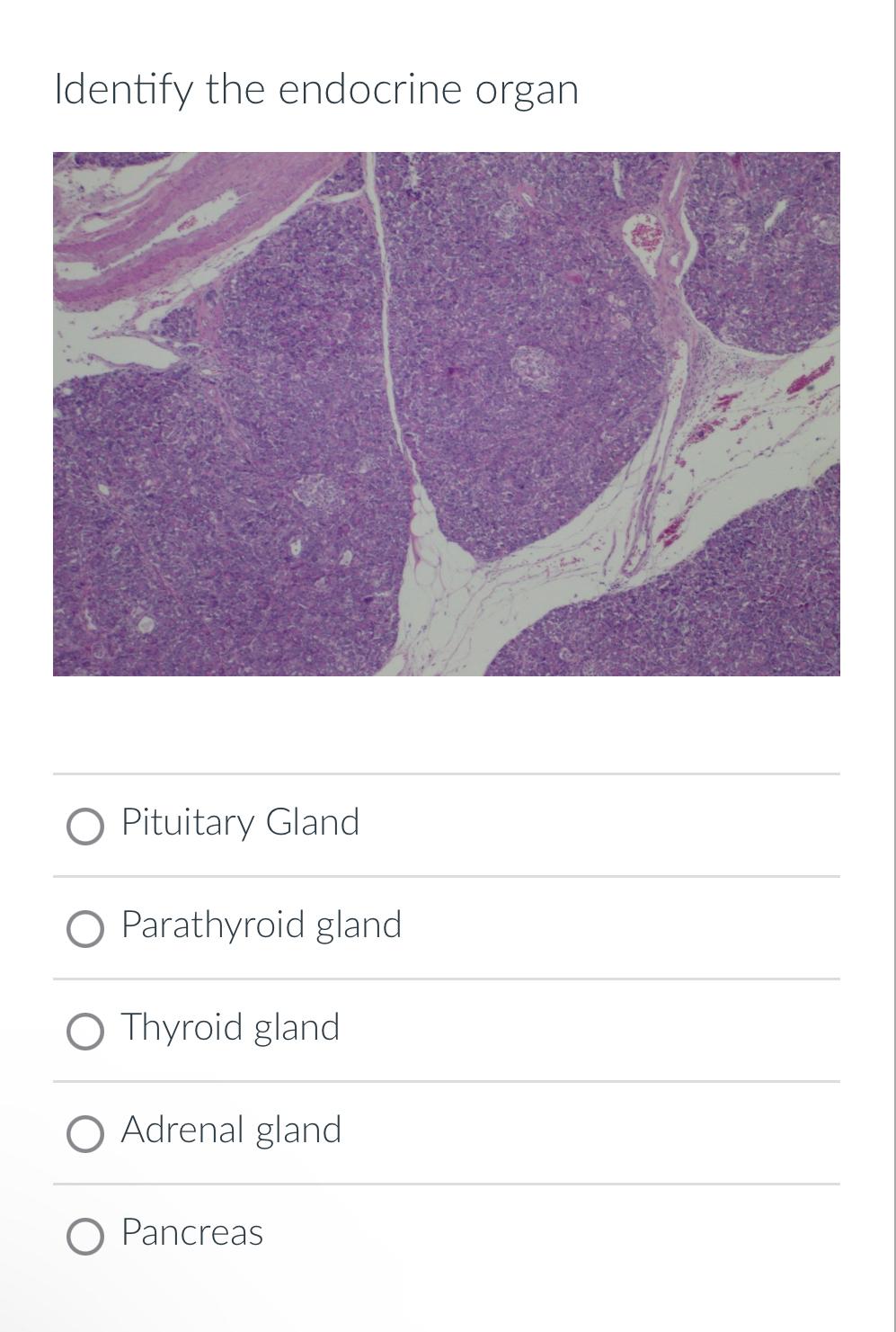 Solved Identify the endocrine organPituitary | Chegg.com