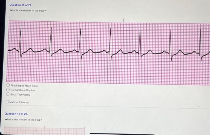 Question 13 of 22 . What is the rhythm in the strip? | Chegg.com