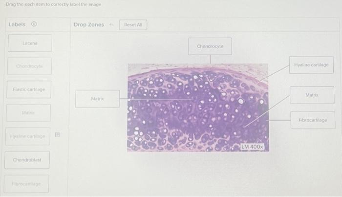 Drag the each arm to correctly label the mage | Chegg.com