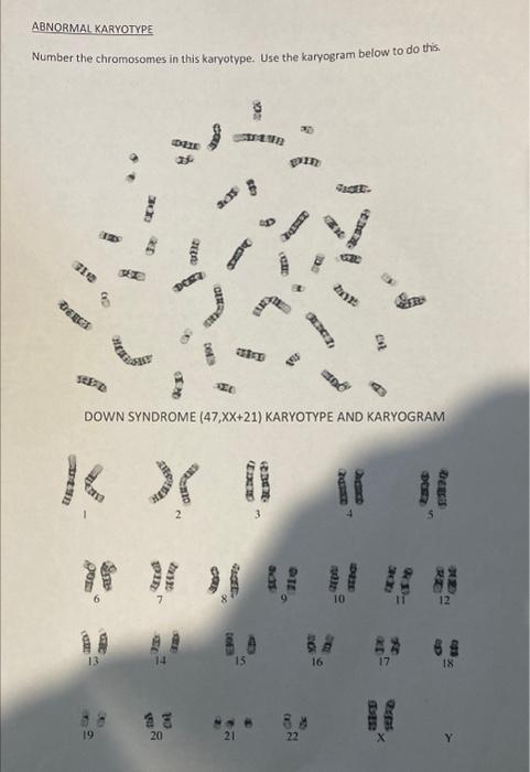 NORIMAL KARYOTYPES Number the chromosomes in this | Chegg.com