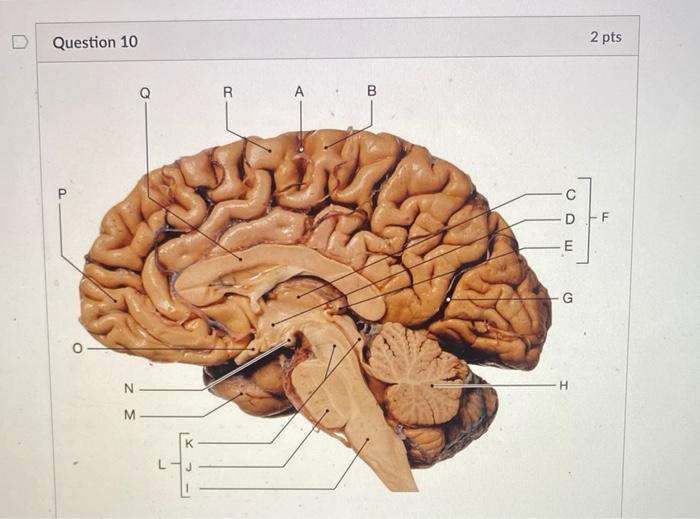Question 10 2 ptsP H J 1 N E D C Q 0 M | Chegg.com Question 10 2 ptsP H J 1 N E D C Q 0 M | Chegg.com