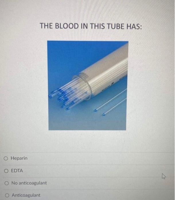 Solved IDENTIFY THE POINTED CELL. O Chief cell O Chromophobe | Chegg.com