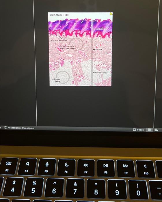 Solved Activity 1. Skin Slides 1. Observe the palmar skin | Chegg.com