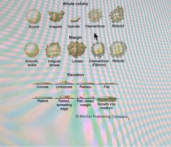 Solved Whole colony Round Irregular Spindle Filamentous | Chegg.com
